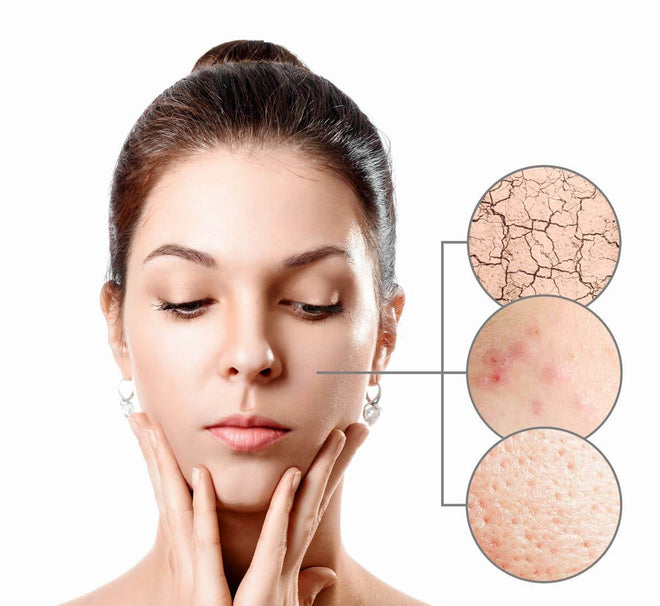 The Effects of Pollution on Skin and How to Protect It – Glopetra